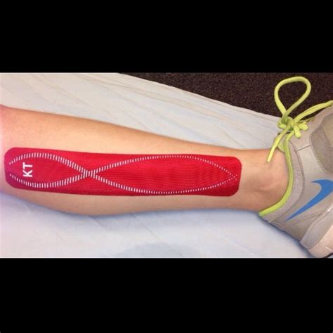 Taping For Post Tib Tendonitis At Marva Owens Blog