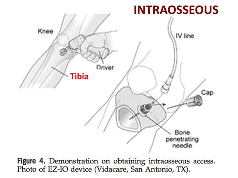 Routes Of Drug Administration Ppt Download