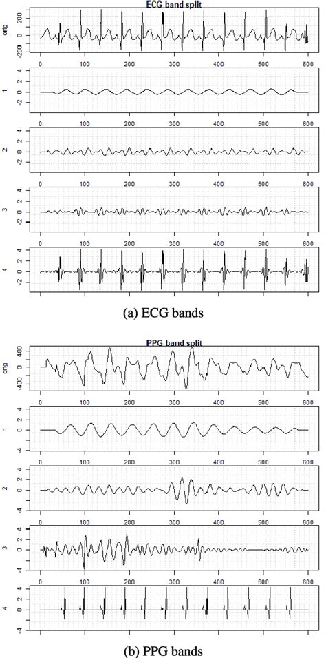 Decomposed Bands Of Ecg And Ppg Signals A And B Show The 4 Band