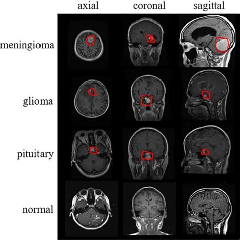A Classification Example From The Original Dataset A Red Outline