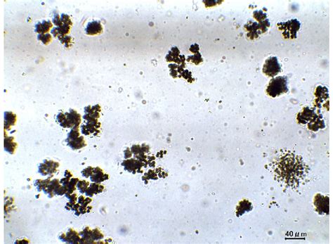 Photographs Of Wild Microcystis Cells Located In The Surface Layers Of