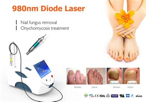 Pin On Laser Therapy