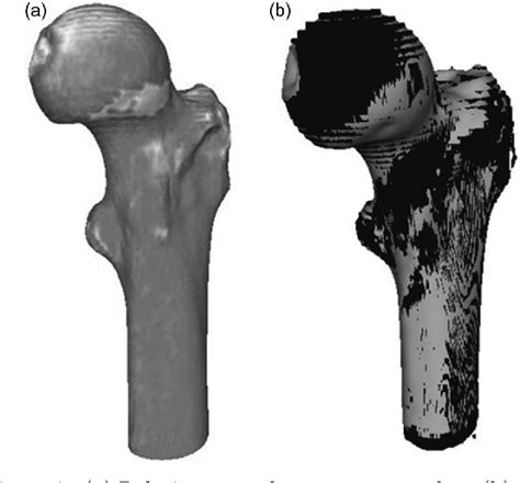 Figure 2 From An Automated Method To Estimate Femoral Shape And Mineral Mass Semantic Scholar