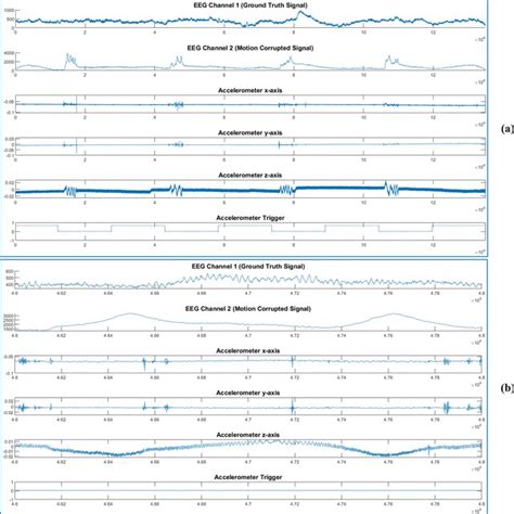 Synchronized Plots For Eeg Signals Ground Truth And Motion Corrupted Download Scientific