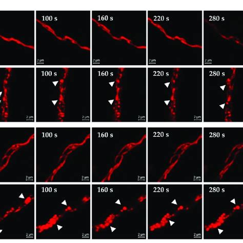 Uncoupler Cccp Induces Irreversible Mitochondrial Constrictions In The