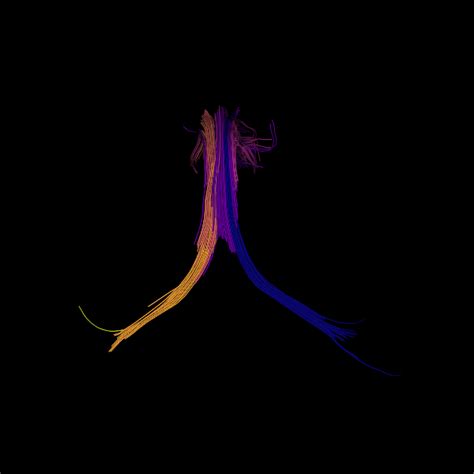 tractography clustering available features — dipy 1 11 0 documentation