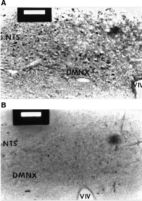 C Fos Proto Oncogene Staining In The Dorsal Medullary Nuclei Of A Download Scientific Diagram