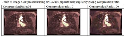 Multiple Image Compression In Medical Imaging Techniques Using Wavelets