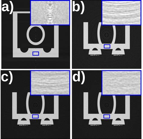 feature sensitive ring artifact correction for computed tomography