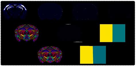 Atlas Based Segmentation Atlas Reference Image Top Left And Raw Data