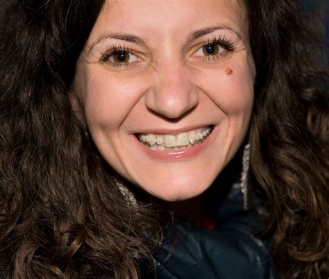 Premium Photo Curly Woman Making A Face While Showing Braces