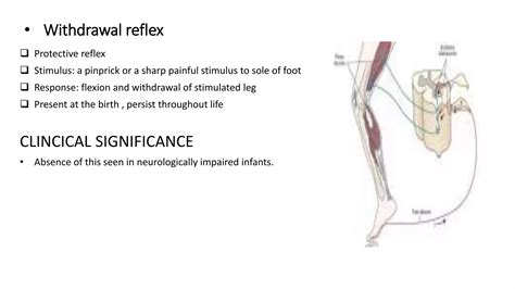Neonatal Reflex Pptx