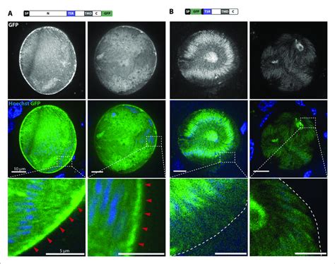 Trp1 Gfp Localizes To The Oocyst Wall While Gfp Trp1dn Accumulates In