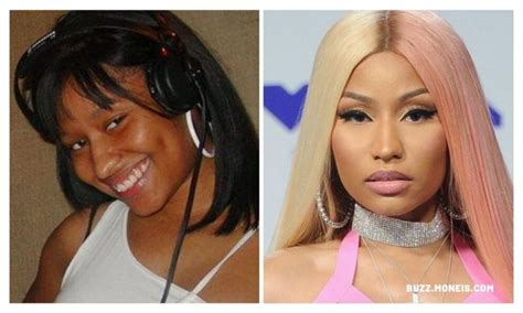 20 Celebs You Didnt Know Had Plastic Surgery And How Much It Cost