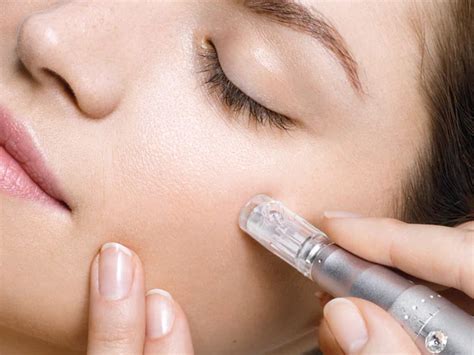 Microneedling Pen Treatment In Sandy Ut Anti Aging