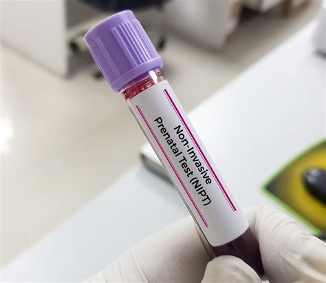 Gender Blood Tests Timing Accuracy And Expectations Bump2Baby Scans