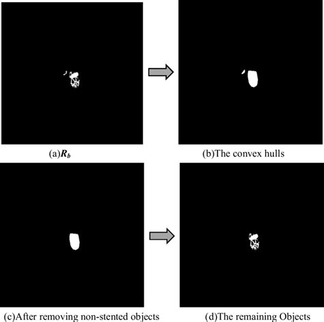 The Processing Of Removing Non Stented Objects Download Scientific Diagram