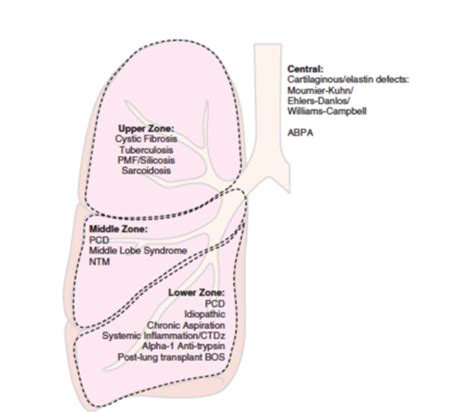 Nbme Review Flashcards Quizlet