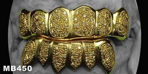 Bling Teeth 52 Pics