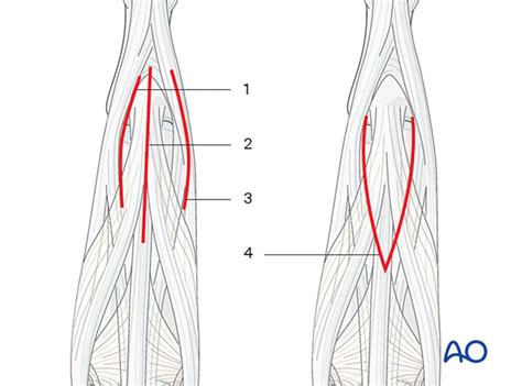 Dorsal Approach To The Pip Joint