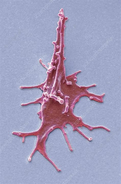 Activated Platelet Sem Stock Image C048 1430 Science Photo Library
