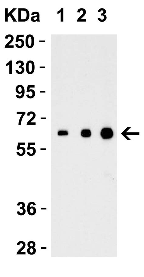 Invitrogen Il 27 P28 Polyclonal Antibody 100 μg Unconjugated