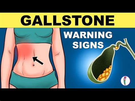 Gallbladder Location Women