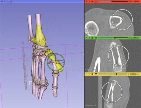 How To Leverage 3d Slicer For Medical Imaging Research And Product Development