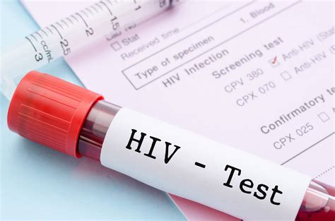 Same Day STD Testing Treatment Preferring An STD Clinic For HIV Screening In Arlington Over A