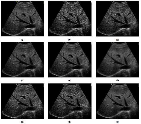 Figure1 Results Of Various Filters On A Multiplicative Noise With Download Scientific Diagram