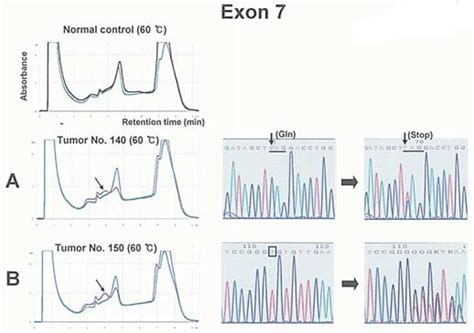 Nf2 Exon 7 Mutation A Nf2 Exon 7 Point Mutation The Shoulder On A