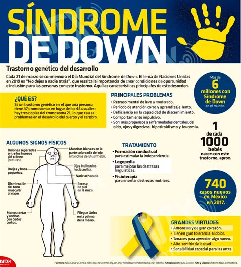 Hoy Tamaulipas Infografía Síndrome De Down