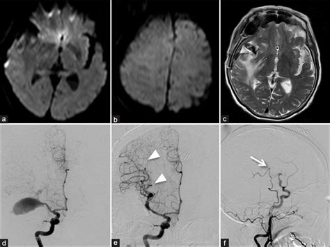 Surgical Neurology International
