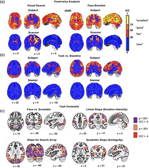 voxel‐wise analysis a scanner effects on temporal signal‐to‐noise