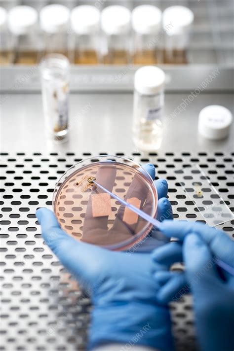 Faecal Sample Analysis Stock Image C0232927 Science Photo Library