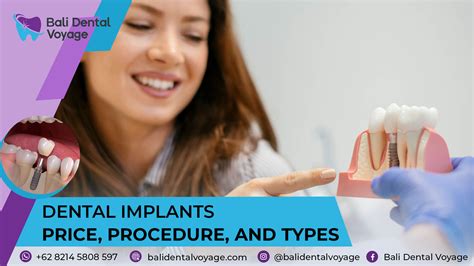 Dental Implants Price Procedure And Types Bali Dental Voyage