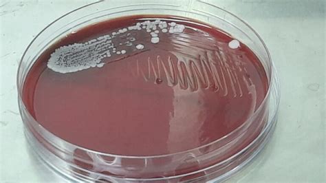 Staphylococcus Epidermidis Introduction Morphology Pathogen