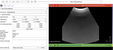 Pixel Spacing For Volume Reconstruction Of Ultrasound Images Support