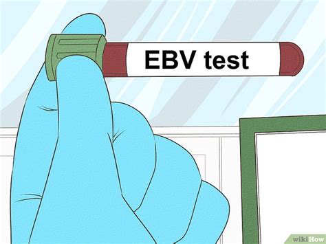 3 Formas De Diferenciar Entre La Amigdalitis Bacteriana Y La Amigdalitis Viral