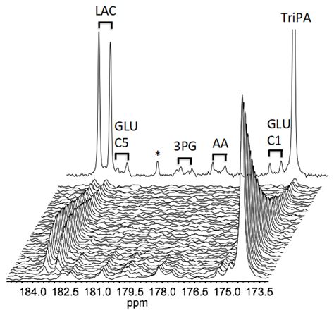 Efficient Hyperpolarization Of U 13c Glucose Using Narrow Line Uv Generated Labile Free Radicals