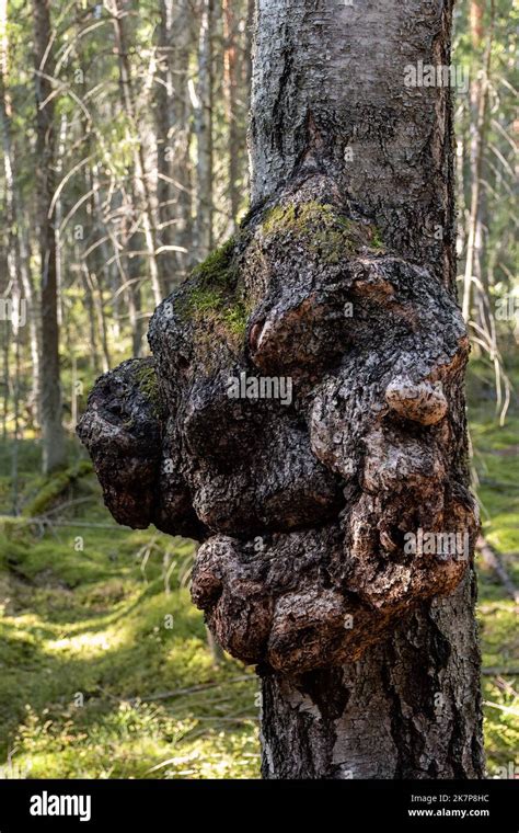 Large Burl Growing On The Trunk Of A Pine Tree In A Finnish Forest