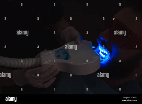 Laser Bleaching Teeth At Dentist Room Teeth Whitening For Men