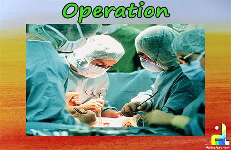 Difference Between Surgery And Operation Diffeology