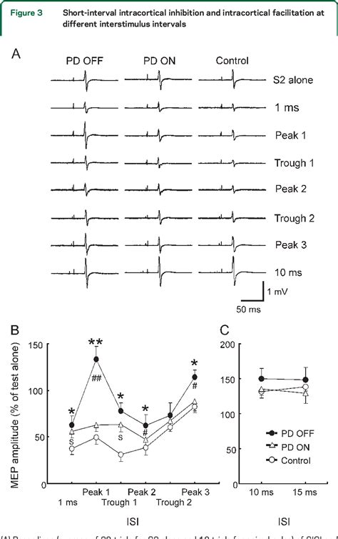Figure 3 From Increased Motor Cortical Facilitation And Decreased