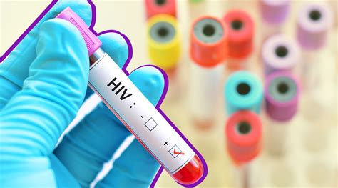 Disminuyen Los Nuevos Casos De Vih En 11 Países