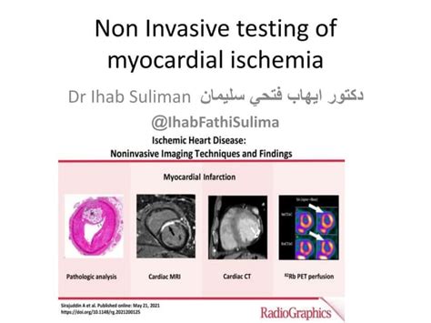 Non Invasive Testing Of Myocardial Ischemia Aa Pptx