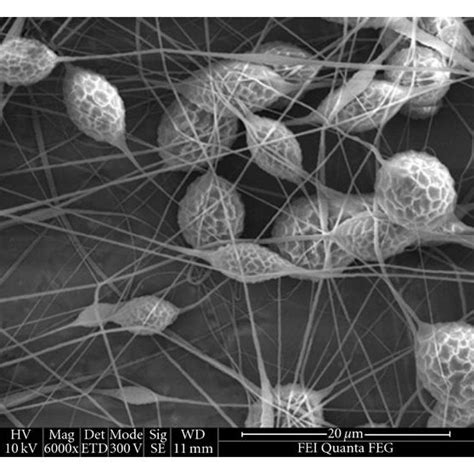 A Tem Of Core Shell Fibers Prepared By Coaxial Electrospinning Download Scientific Diagram