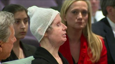 Chimp Attack Victim Charla Nashs Body ‘moderately Rejecting Face