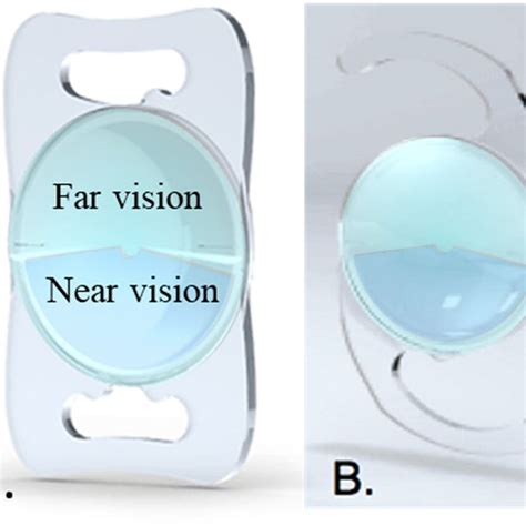 Tangential Curvature Maps In Diopters Of The 3 Clinical Cases Evaluated