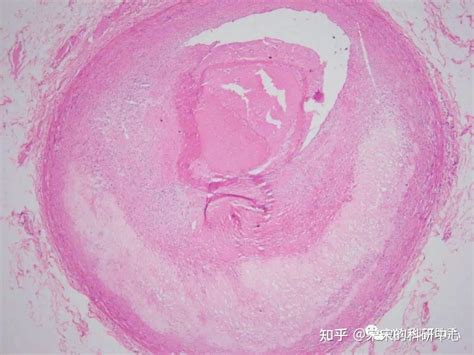 切片学习 常规病理组织切片及诊断要点 知乎